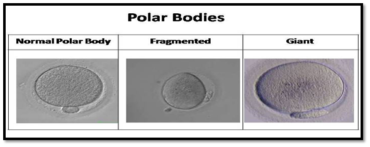 Oocyte Grading: Understanding Egg Quality for IVF Success